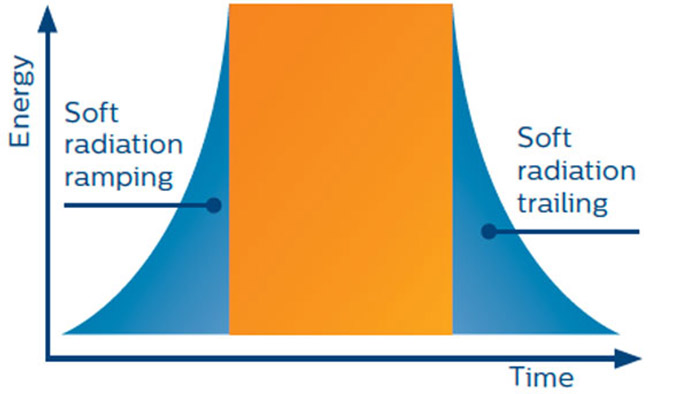 Grid Controlled Fluoroscopy – dose rate reduction | Philips